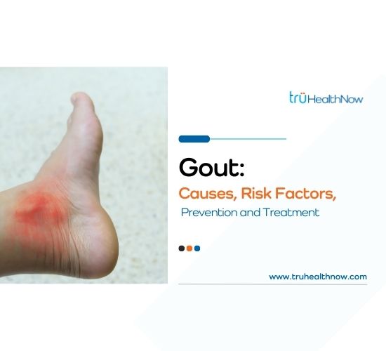 Gout: Causes, Risk Factors, Prevention & Treatment | trüHealthNow